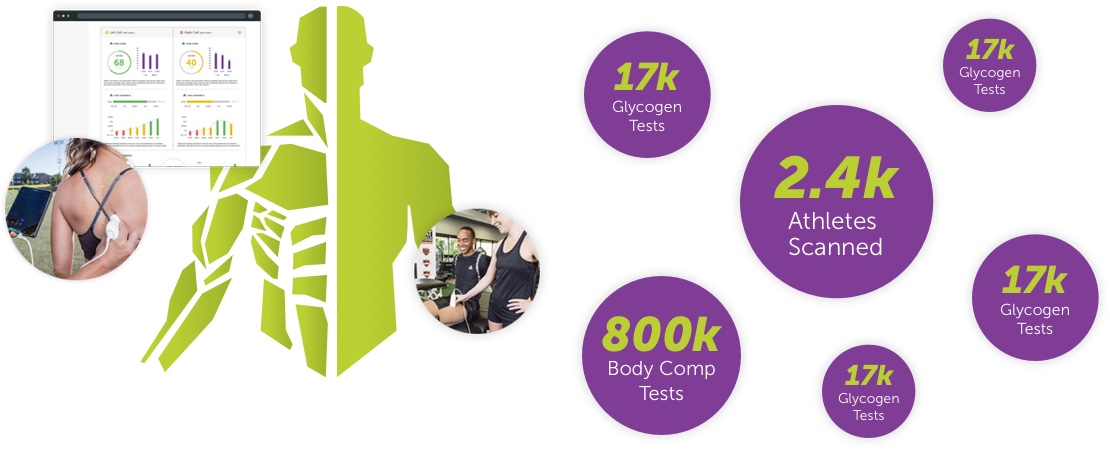 Category: Monitor Muscle Size | MuscleSound